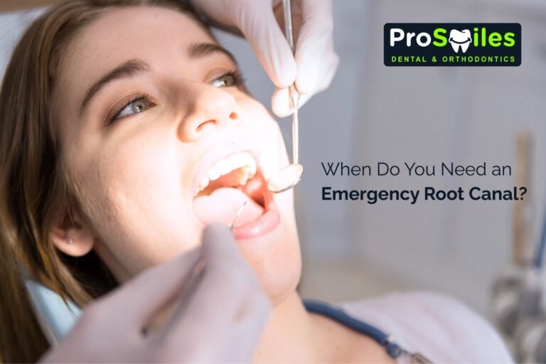 When Do You Need an Emergency Root Canal? — ProSmiles