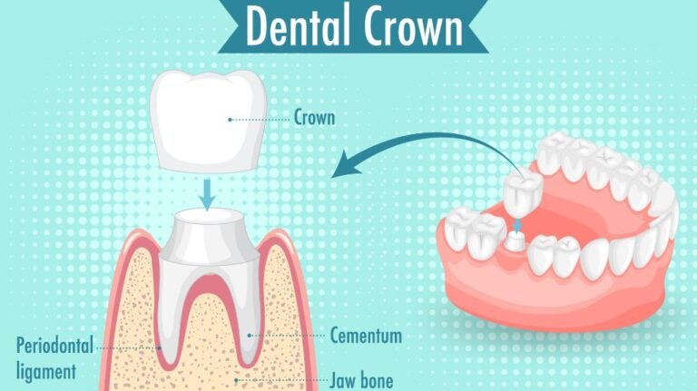 Why Crowns on Front Teeth Are Different — ProSmiles
