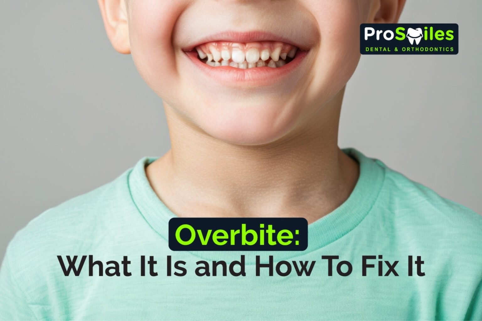 How Do You Fix an Overbite and What Is It? — ProSmiles