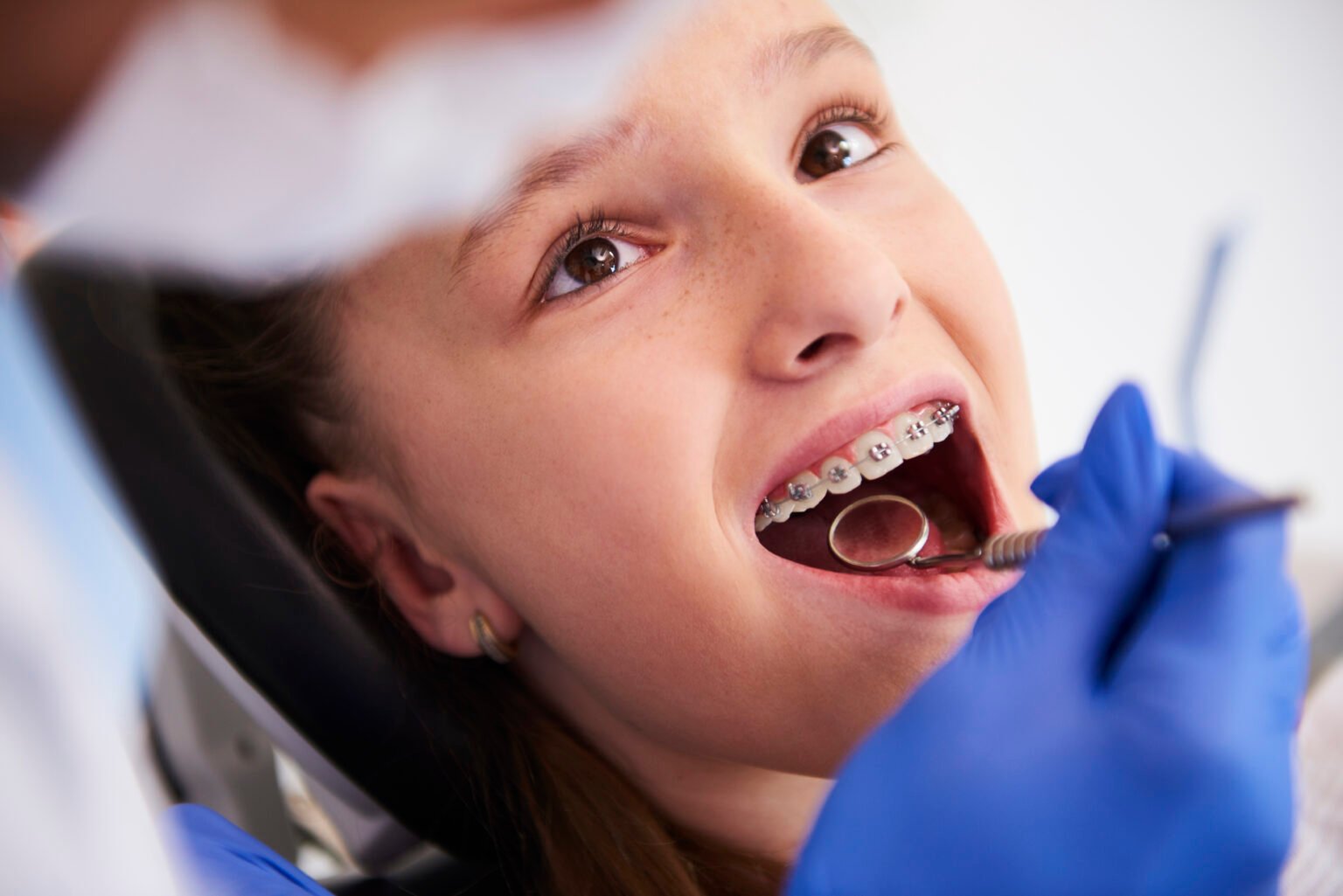 Top Dental Services in Hurst for Exceptional Care | ProSmiles